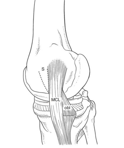 膝关节内侧副韧带（mcl）磁共振解剖要点 知乎