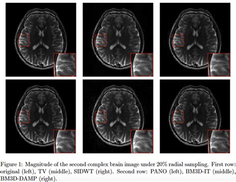 Bm3d Amp Mri Project Page