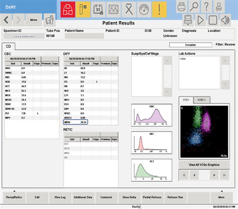 Monocyte Distribution Width Beckman Coulter