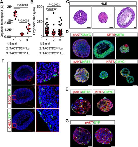 Human Prostate Luminal Cells Overexpressing Caakt1 And C Myc Exhibit