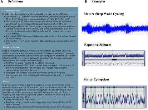 A Suggested Classification Of Aeeg Patterns In Preterm And Term Download Scientific Diagram