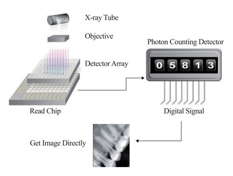 Supply Small Size Dental Radiography Digital Intraoral Sensor Wholesale Factory Foshan