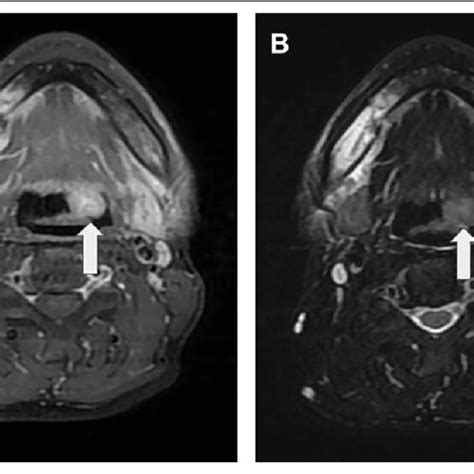 13 Three Dimensional Electromagnetic Articulography Ema Device A Download Scientific