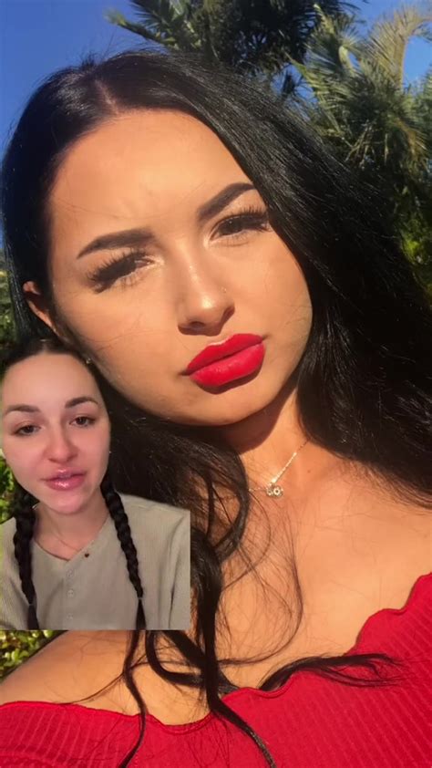 I Have A Really Small Chin And I Get It Filled Every Year To Get A Snatched Jawline People