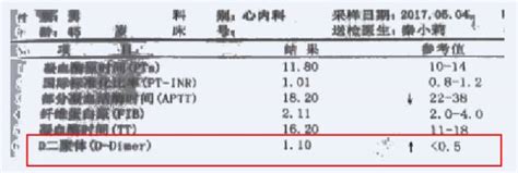 突发胸痛D二聚体升高病因竟是 搜狐大视野 搜狐新闻