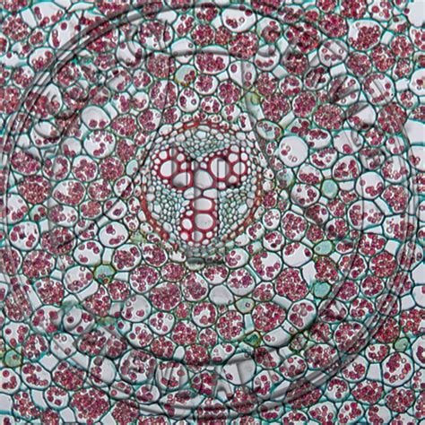 Ranunculus Acris Root Maturing Metaxylem Prepared Microscope Slide