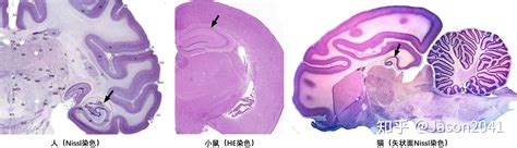 脑海马结构简介 知乎