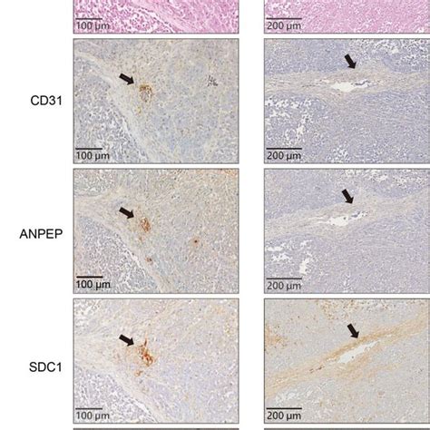 Immunostaining Showed Different Vascular Phenotypes With Different