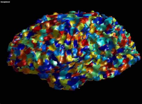 Mapping Human Whole Brain Structural Networks With Diffusion Mri