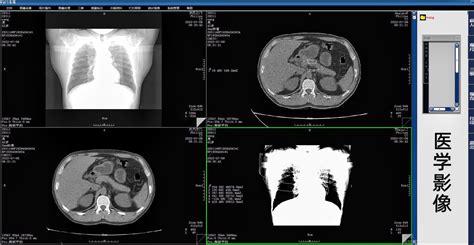 【c 医学影像pacs】ct检查中的三维重建技术 腾讯云开发者社区 腾讯云