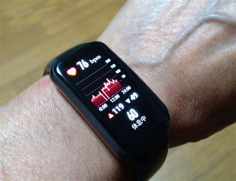 スマートウォッチで心電図！ ソフテイルのブログ