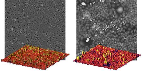 Quantitative Phase Imaging Phi