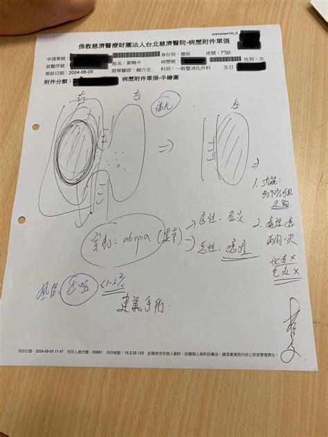 甲狀腺腫瘤 穿刺結果 惡性 很多人問我心裡有震撼嗎 會不會難過 真的完全沒有 我比較擔心麻醉把我的秘密說出來 威 而且要等腫瘤拿出來以後