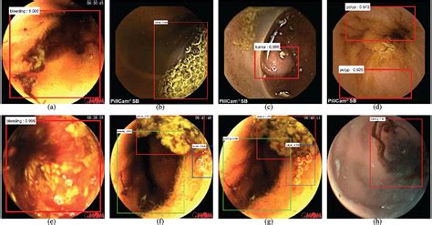 Figure 7 From Deep Convolutional Neural Networks For Wce Abnormality