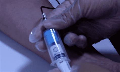 Prp Preparation Procedure Prp Kit Prp Tube Platelet Rich Plasma Needle Cannula