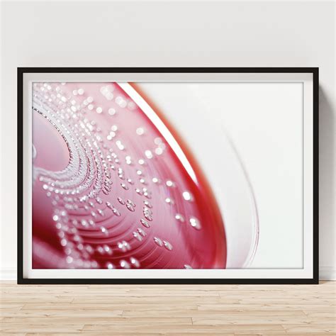 Staphylococcus Aureus Culture Poster By Science Photo Library Science Photo Gallery