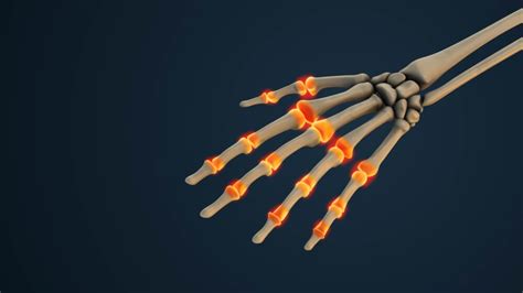 Iantrek Raises 42 Million Series C To Launch Alloflo™ Uveo A