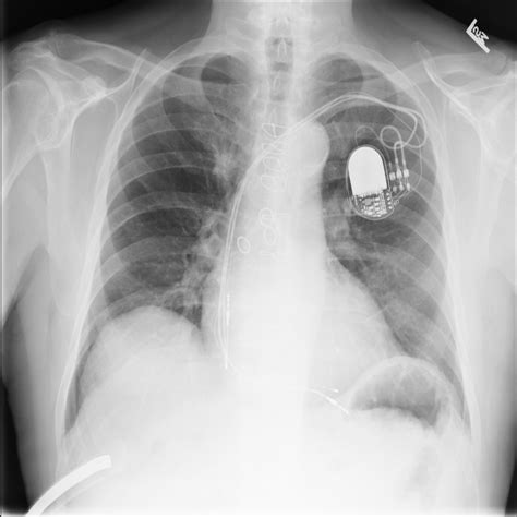 Ge Healthcare Hackathon Instance Segmentation Dataset By Chequeautodataentry