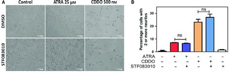 Stf083010 Inhibition Of Neuroblastoma Differentiation Is Specific For