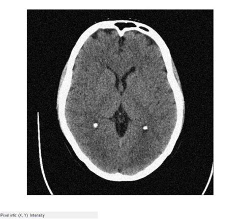 blog image processing via fuzzy logic toolbox matlab helper