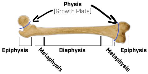 Salter Harris Fracture Classification System Mnemonic Type 48 Off