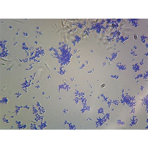 Prepared Microscope Slide Corynebacterium Diphtheriae