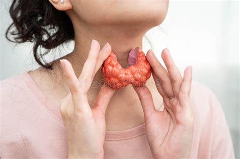 Hyperthyroidism Overactive Thyroid Thyroid Lymphoma Asian Woman With Thyroid Gland Human