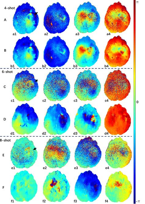 figure 2 from deep learning based multiplexed sensitivity encoding dl muse for high resolution