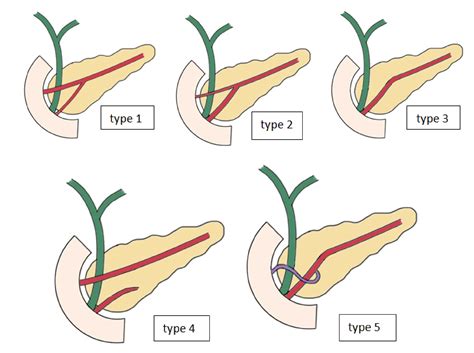 Pancreas Anatomy