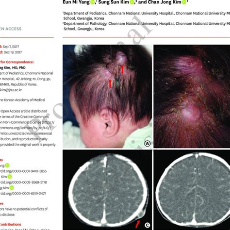 Gross And Ct Image Of The Skin A B Gross Views Of The Scalp C D Download Scientific