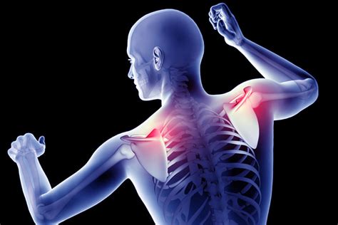 Suprascapular Nerve Block In Wichita KS SpineMed Specialists