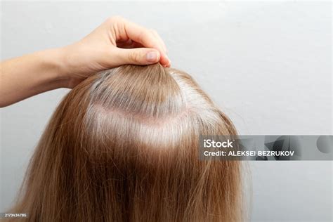 흰머리 뿌리를 보여주고 클로즈업 젊은 여자에서 회색으로 변합니다 머리가 희끗희끗해지고 있습니다 조기 노화 문제 강세 머리