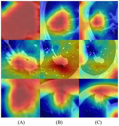 A Multi Kernel And Multi Scale Learning Based Deep Ensemble Model For