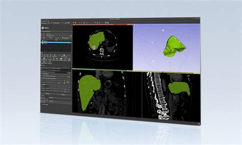 Building Image Segmentation Faster Using Jupyter Notebooks From Ngc Nvidia Technical Blog