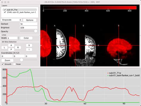 Mricrogl Tutorial 3 Viewing Images — Andys Brain Book 10 Documentation