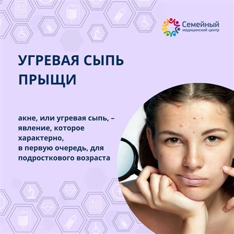 Semeinyi Medcenter Не давить дома не лечить ⠀ ⠀ А что Вы знаете об угрях и прыщиках
