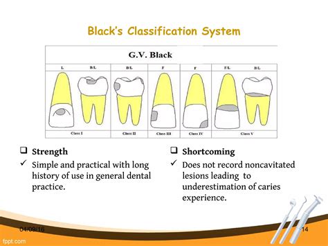 International Caries Detection And Assessment System Icdas Ppt