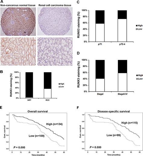 runx3 regulates renal cell carcinoma metastasis via targeting mir 6780a