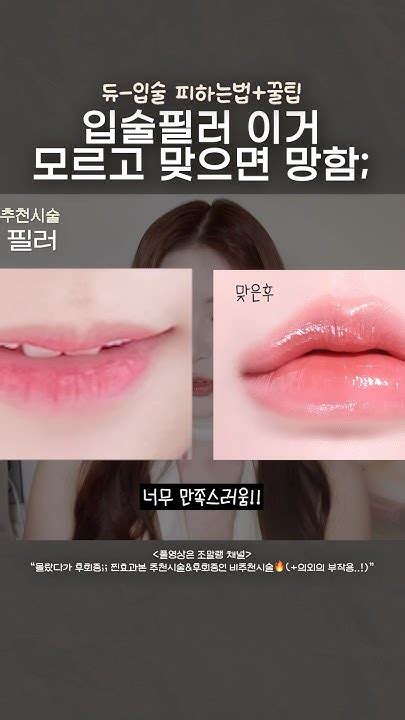 입술필러 이거 모르고 맞으면 망함⚠️ 필러 전 필수시청💥 필러 시술추천 부작용 시술후기 시술비추천 필러 뷰티꿀팁
