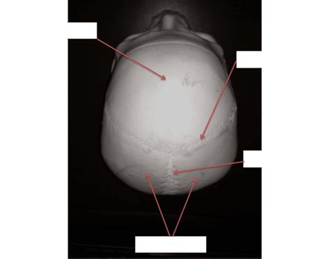 Anatomy Lab Page 1 For Axial Skeleton Quiz