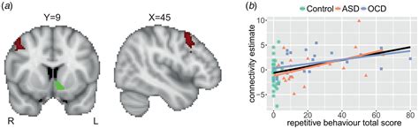 Frontostriatal Functional Connectivity Correlates With Repetitive