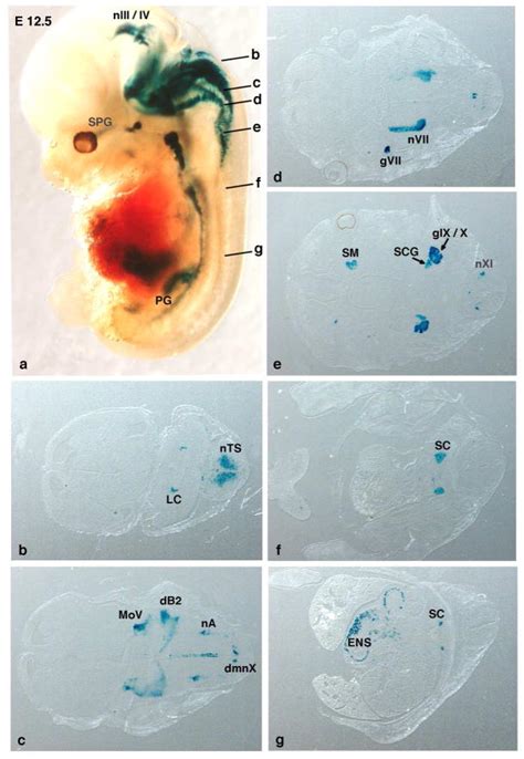 A Phox2b Flpo Transgenic Mouse Line Suitable For Intersectional Genetics Pmc