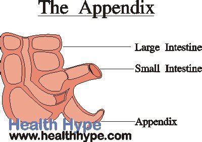 Warning Signs Of A Dangerous Burst Appendix Healthhype Com