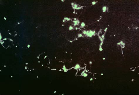 Free Picture Photomicrograph Fluorescent Antibody Stain Leptospira Bacteria Liver