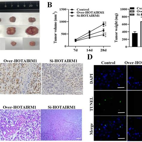Overexpression Of Hotairm1 Promotes Glioma Tumor Growth And Vm Download Scientific Diagram