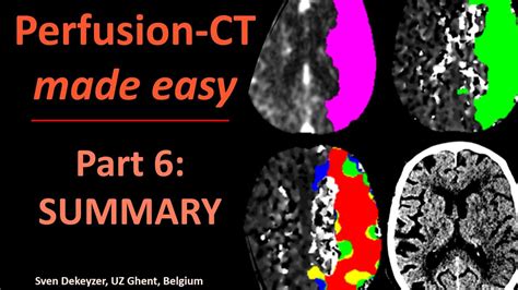 Perfusion Ct Made Easy Part 6 Summary Youtube
