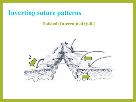 Basic Suture Patterns