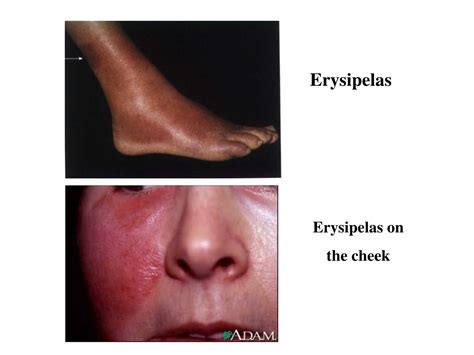 Ppt Staphylococcus Classification And Characteristics Powerpoint