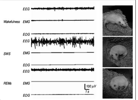Electrographic Recording Of Our Laboratory Which Shows Cortical Download Scientific Diagram