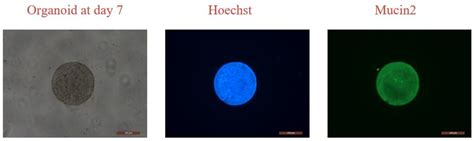 An Automated Digital Microfluidic System Based On Inkjet Printing